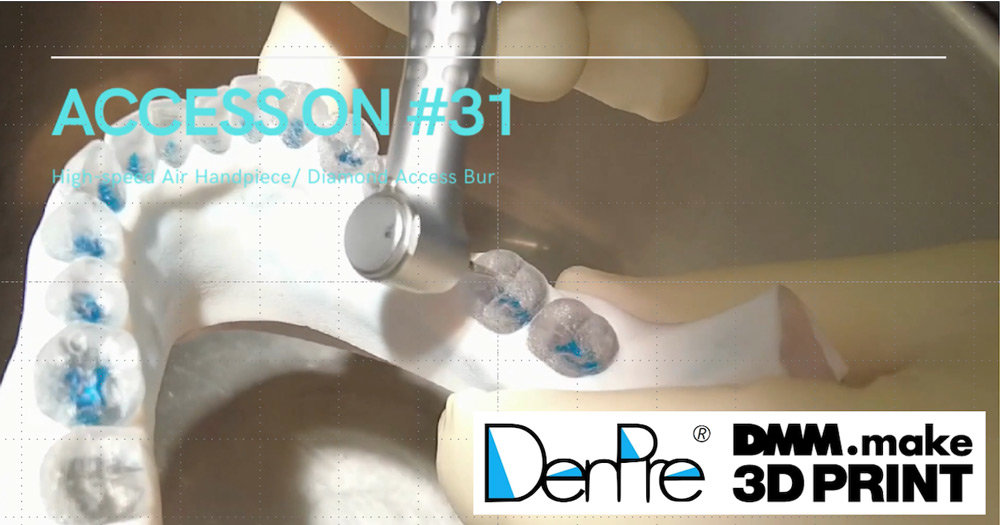 3Dプリント技術を用いた歯科模型造形サービスを提供：3Dプリンタニュース - MONOist