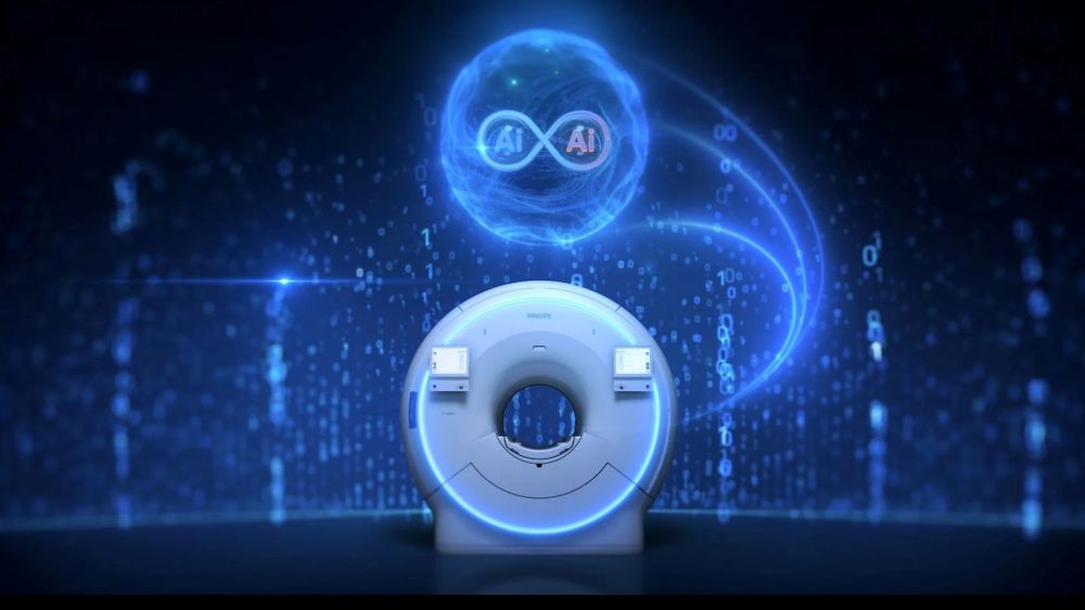 2つのAIエンジンを用いてMRIがより高速かつ高画質に：医療機器ニュース - MONOist